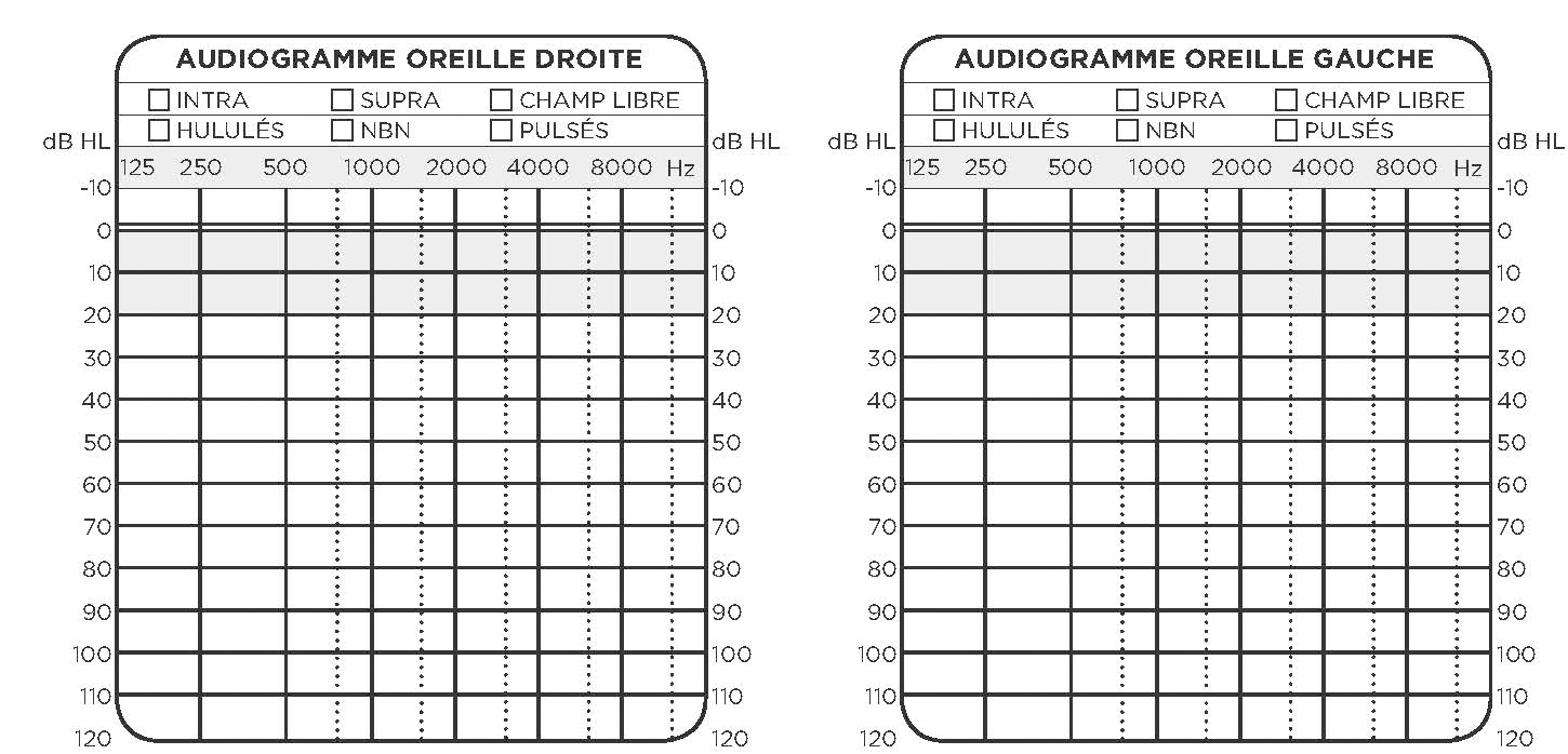 Audiogramme_graphique_1 - Polyclinique de l'Oreille